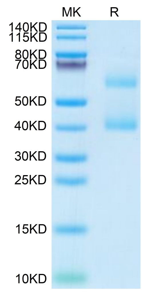 Mouse MEPE Protein, Accession: Q8K4L6 Watson International Limited