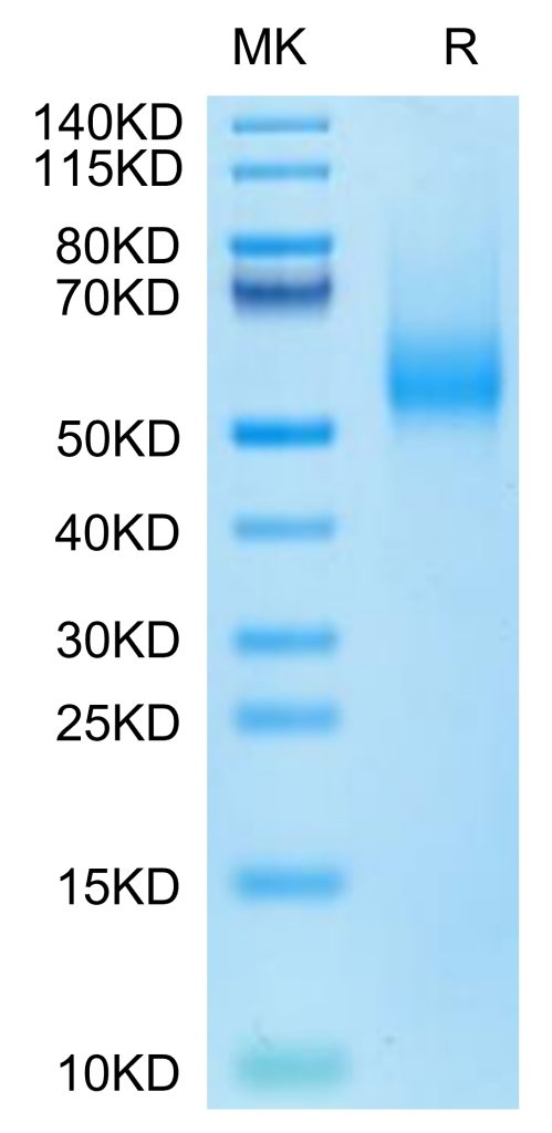 Biotinylated Human CDH17/Cadherin 17 Domain 5-7 Protein (Primary Amine ...