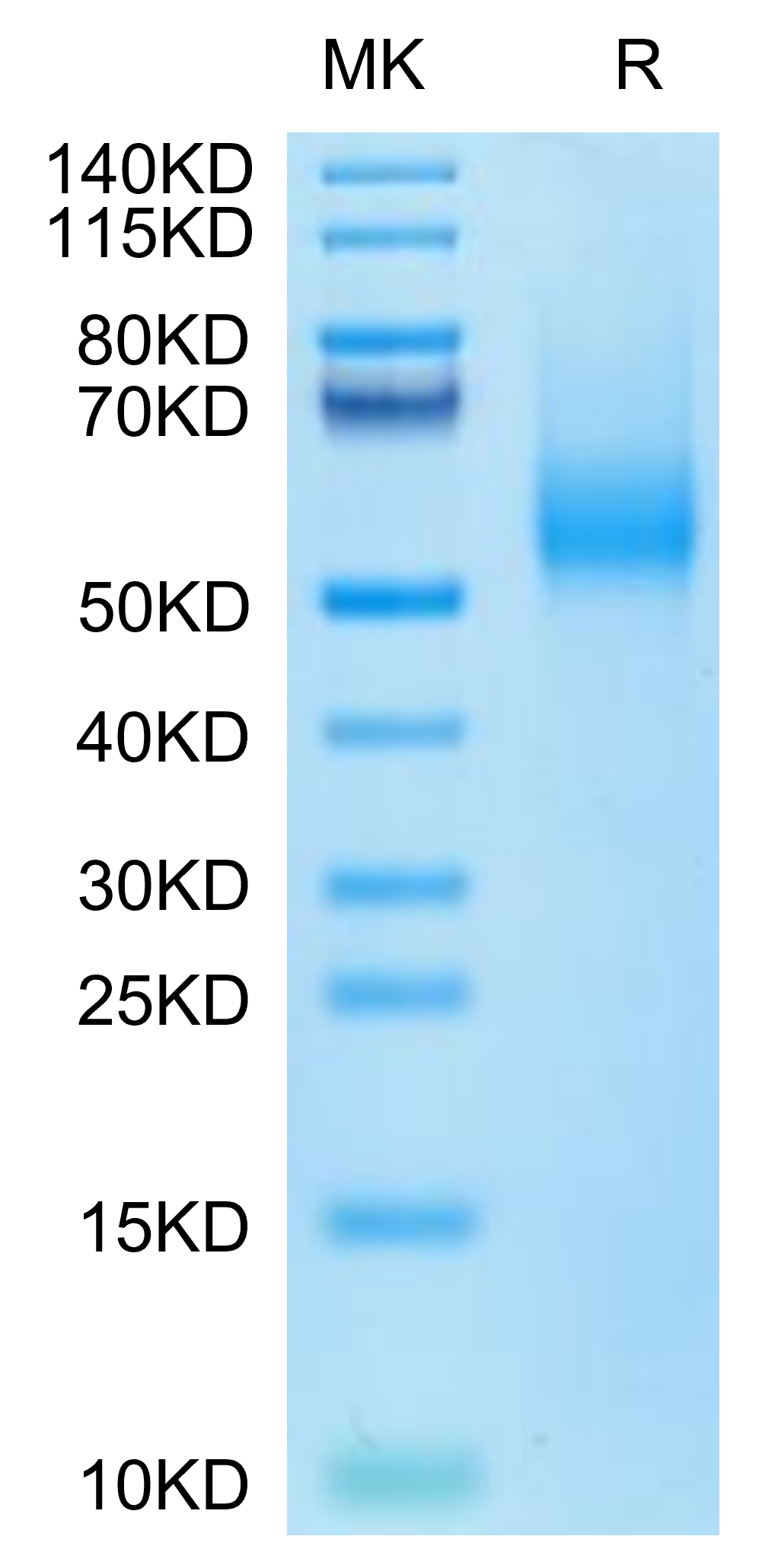 Biotinylated Human CDH17/Cadherin 17 Domain 5-7 Protein (Primary Amine Labeling), Accession ...