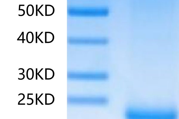 Mouse MOG/Myelin Oligodendrocyte Glycoprotein Protein, Accession ...