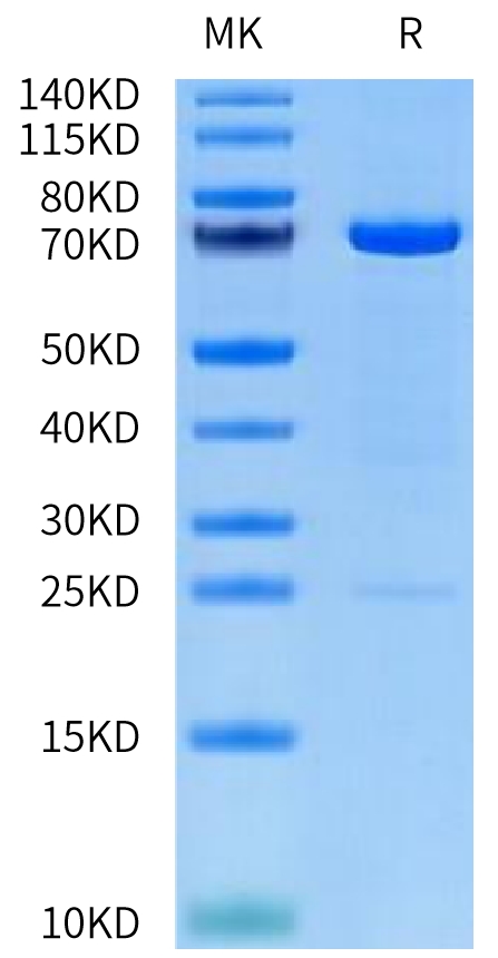 Human MMP-2 Protein (pro form), Accession: P08253 Watson International ...