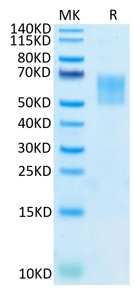 FITC-Labeled Human TPBG/5T4 Protein, Accession: Q13641 Watson International Limited