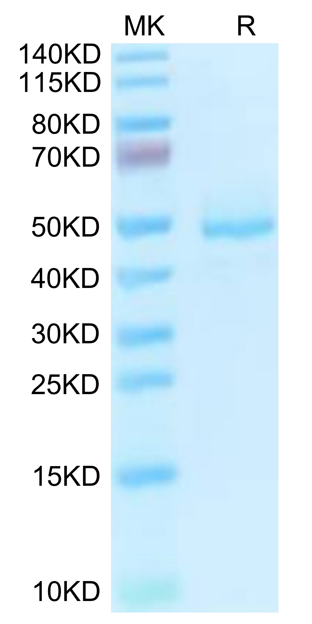 Human GP1BB Protein, Accession: P13224 Watson International Limited