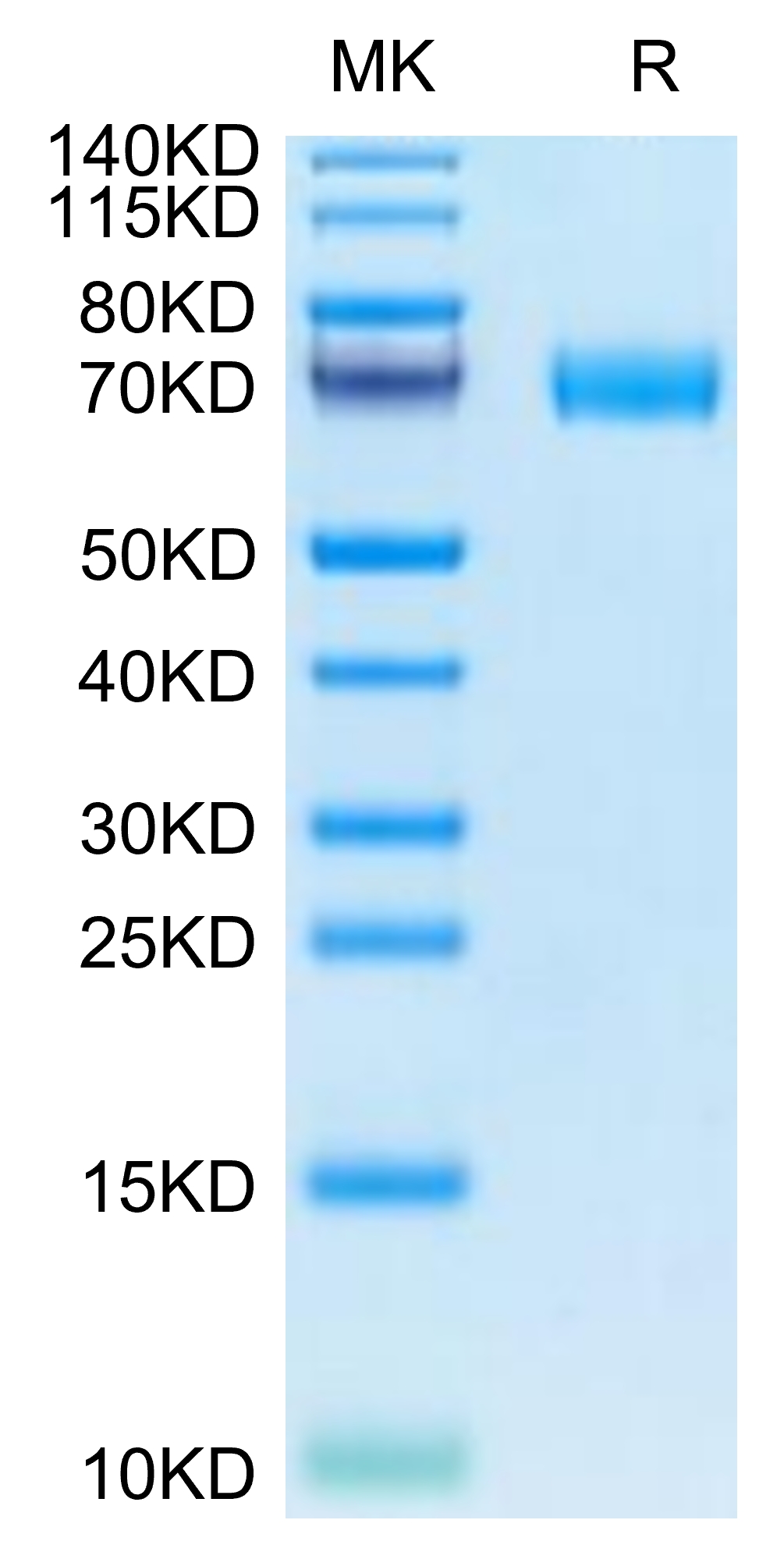 Canine MRC2 Protein, Accession: A0A8I3NWU4 Watson International Limited