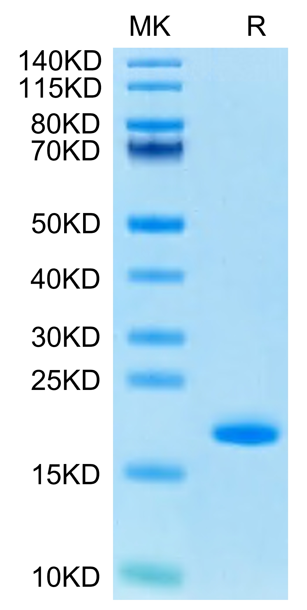 Human FGF basic (154aa) Protein, Accession: P09038 Watson International Limited