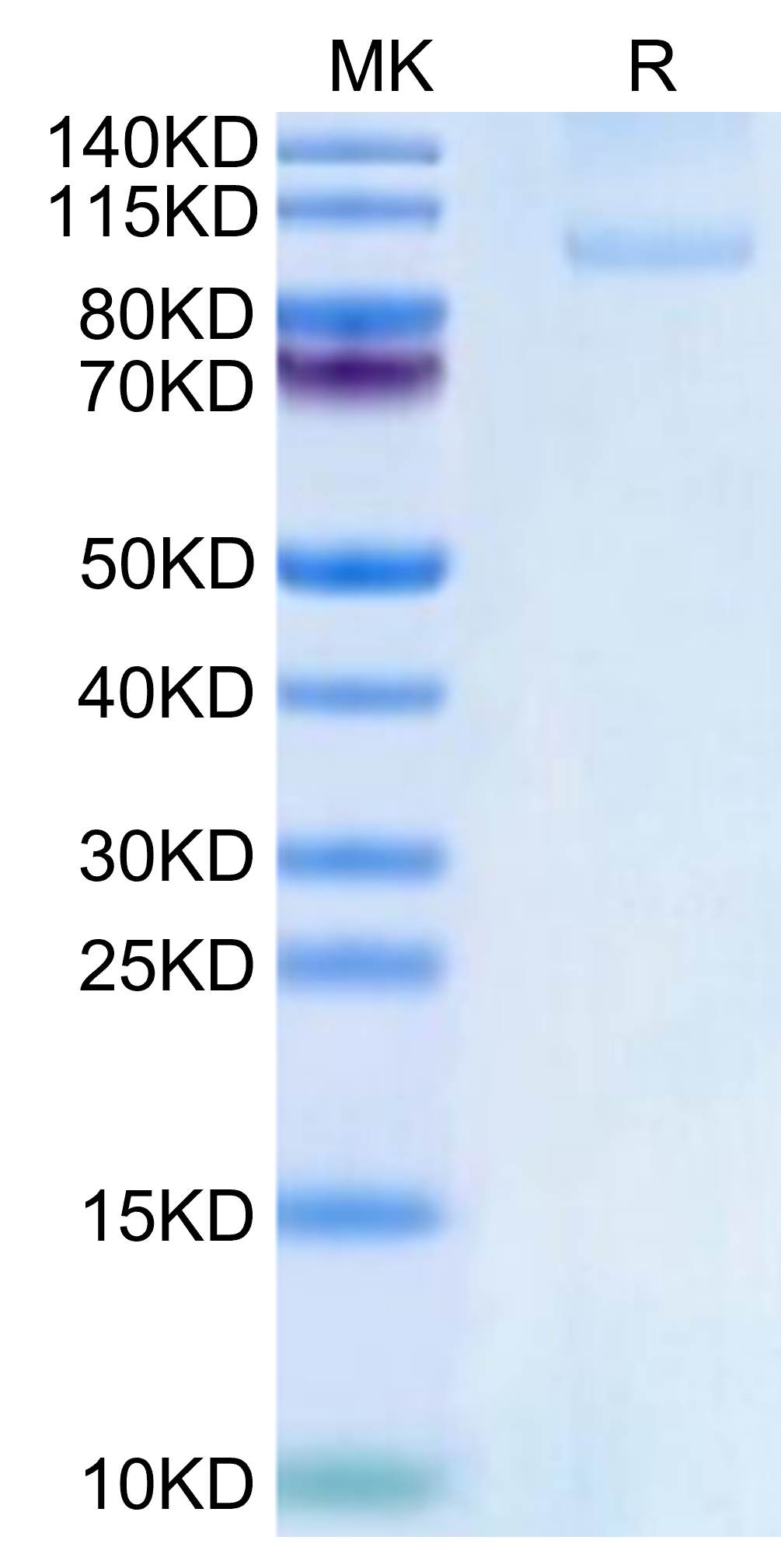 Rhesus macaque CDH17/Cadherin 17 Protein, Accession: A0A1D5R2B4 Watson ...