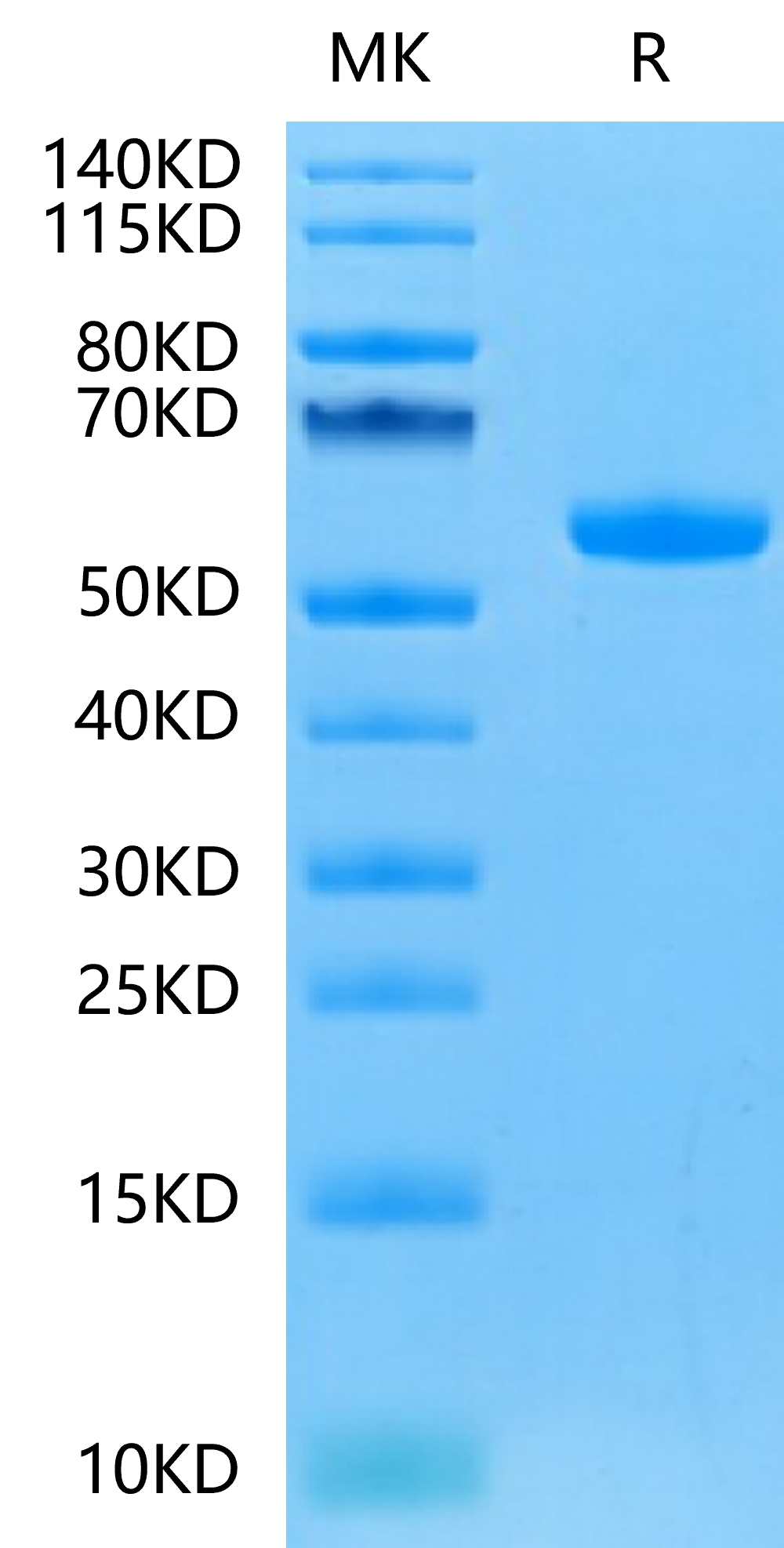 Human FGF21 Protein, Accession: Q9NSA1 Watson International Limited