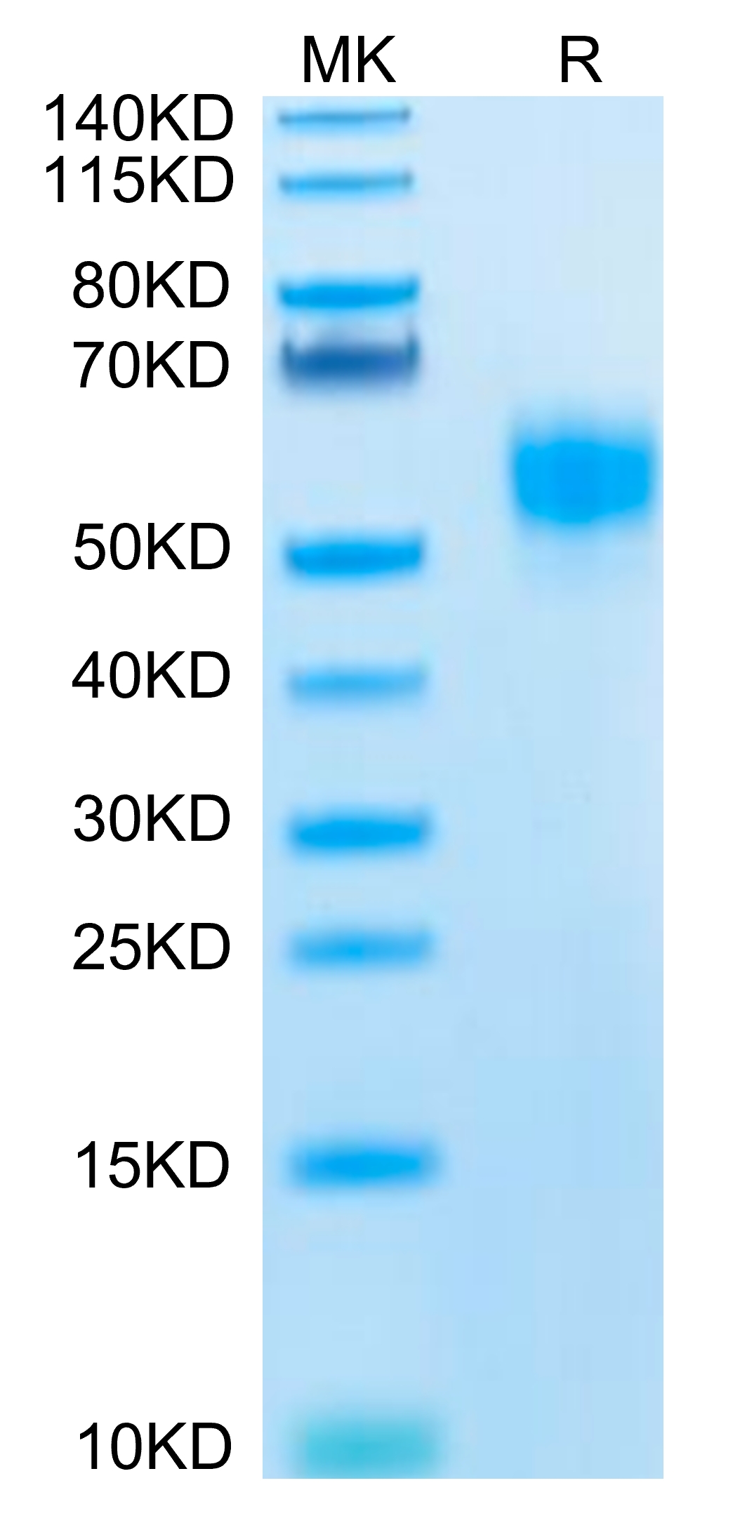 Human SIRP alpha V5 Protein, Accession: P78324 Watson International Limited